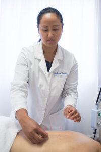 Acupuncture in Long Beach - Little Sage Acupuncture & Herbal Medicine