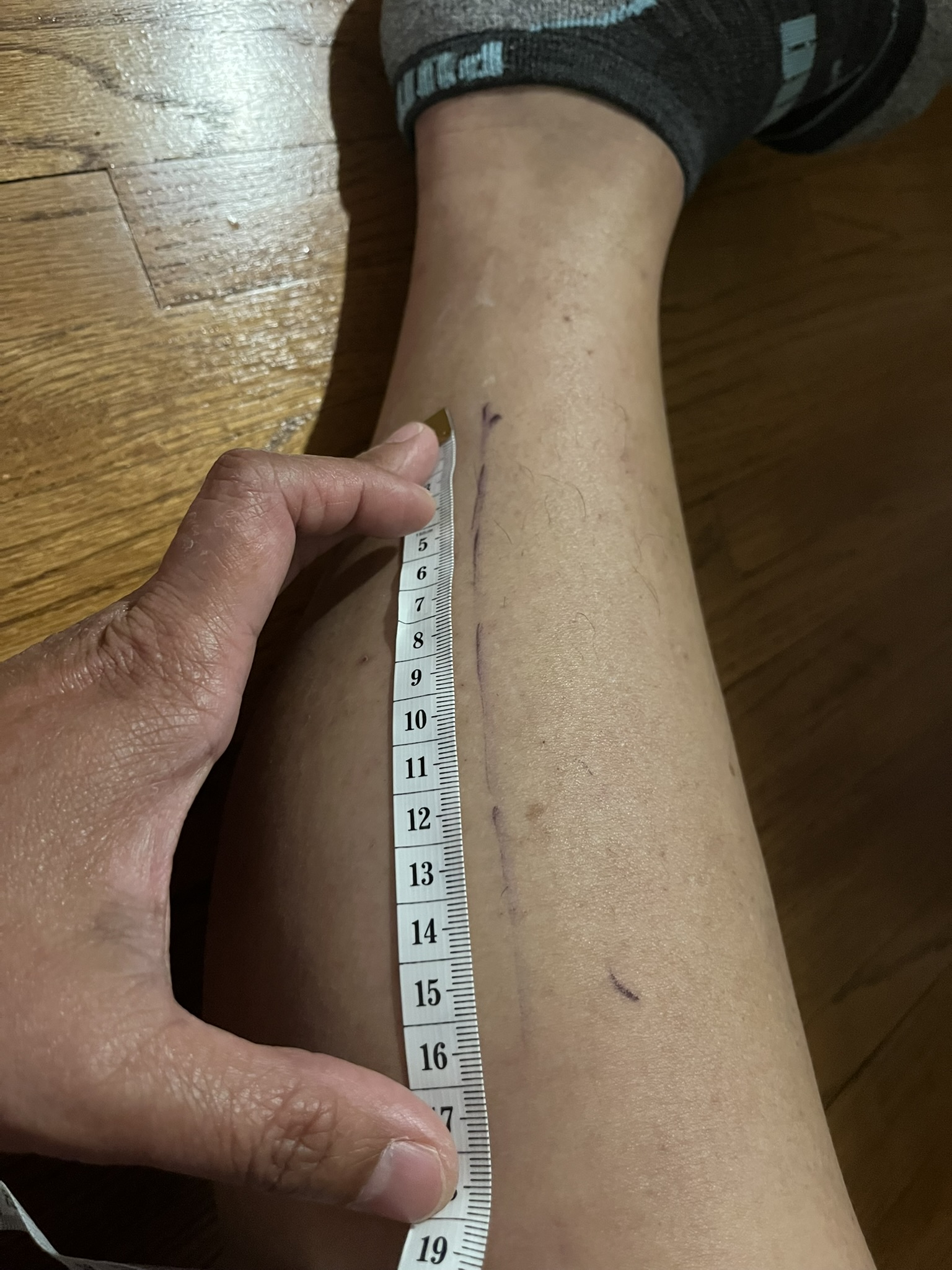 Advocating for Myself: Lessons Learned from a Calf Injury - Little Sage ...